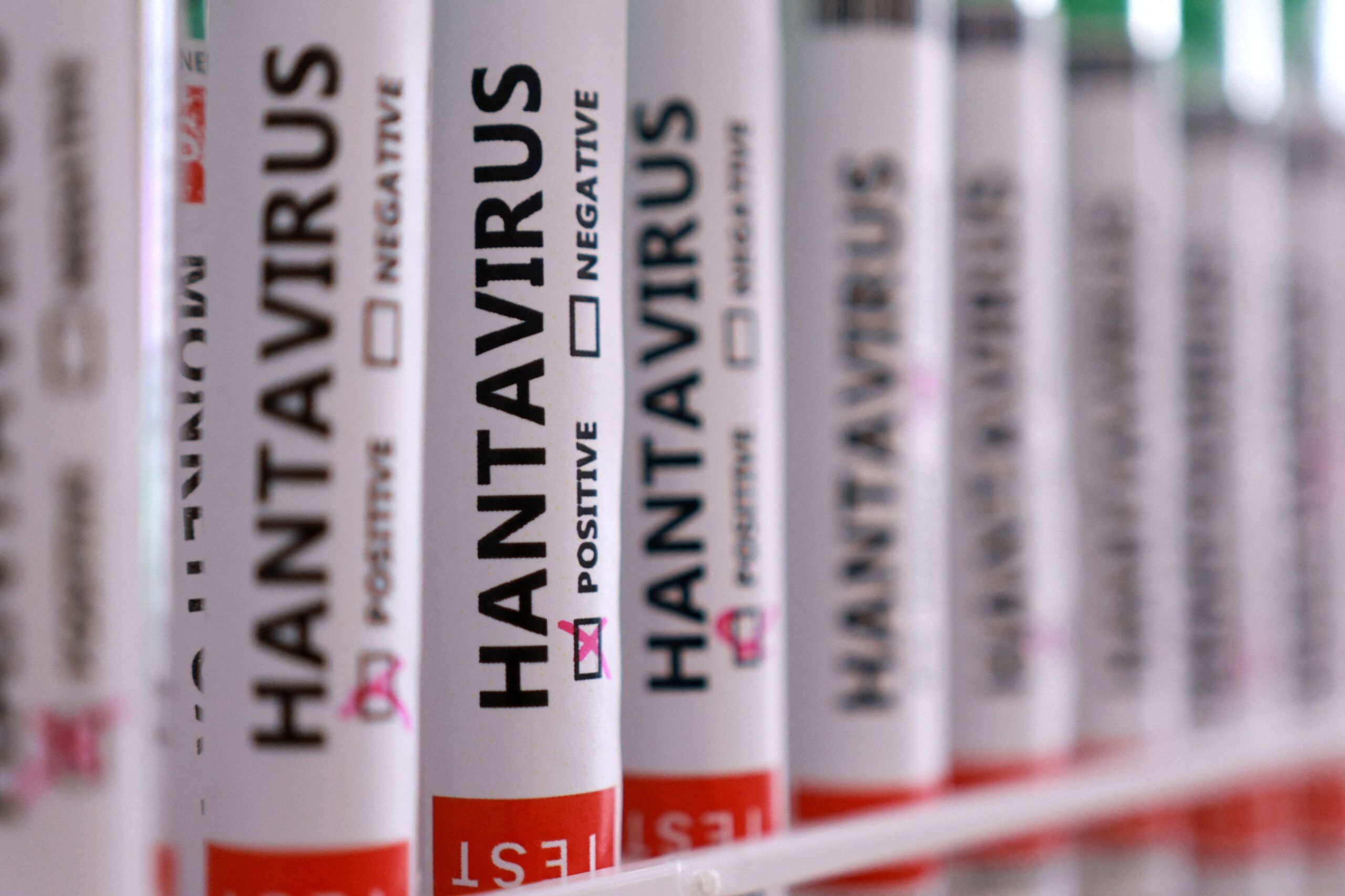 Governo descarta relação entre casos de hantavírus no Brasil e surto em ...