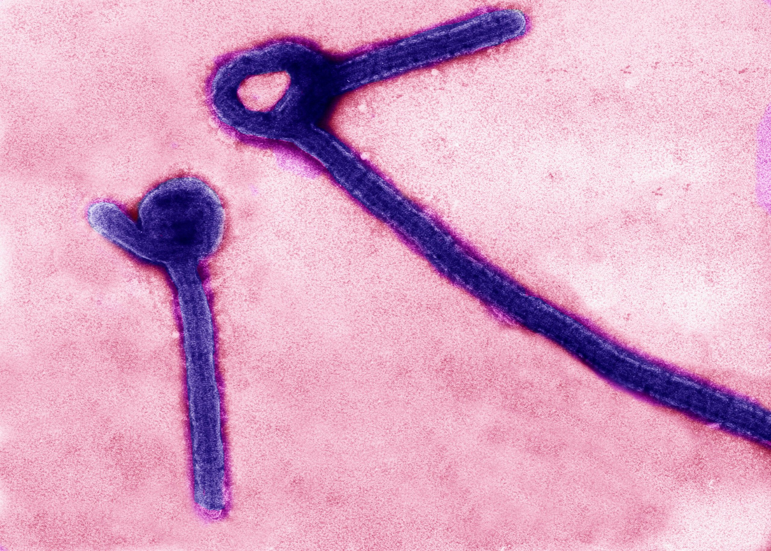 RS investiga ebola após teste positivo para malária em paciente | TMC